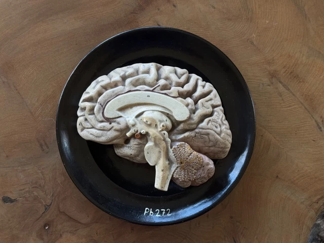 VERY RARE BOCK-STEGER Lips Sagittal Brain Plaster Model, C 1890 German ...