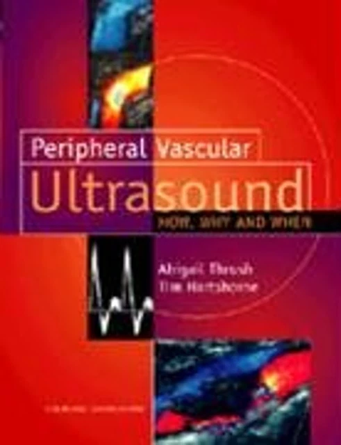 PERIPHERAL VASCULAR ULTRASOUND : How, Why and When Paperback £11.69 ...