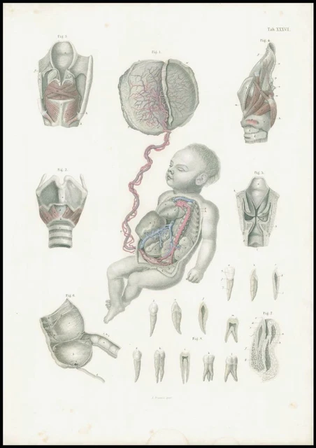1878 ANATOMY FOETAL PLACENTA UMBILICAL CORD LARYNX TEETH Muscles Bock ...