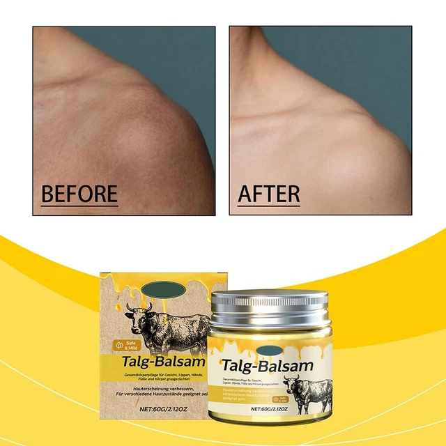 ORGANIC GRASS-FED BEEF Tallow Balm with Honey Moisturize Cream Health ...