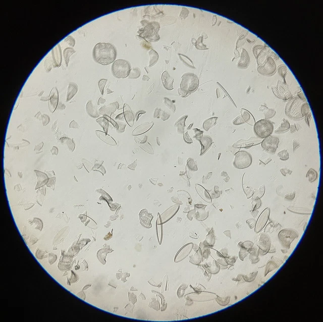 ANTIQUE DIATOM MICROSCOPE Slide. Fossil Diatoms From Sweden. By Wheeler ...