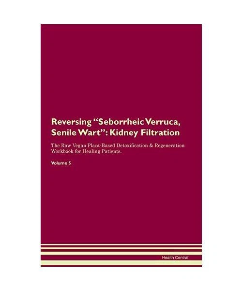 REVERSING SEBORRHEIC VERRUCA, Senile Wart: Kidney Filtration The Raw ...