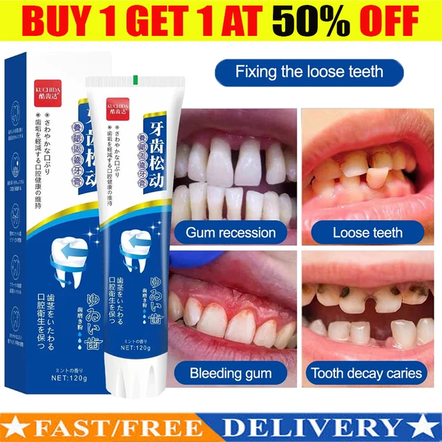 LOOSE TEETH CARE Toothpaste Repair Gingivitis Cavities Prevention Fresh ...