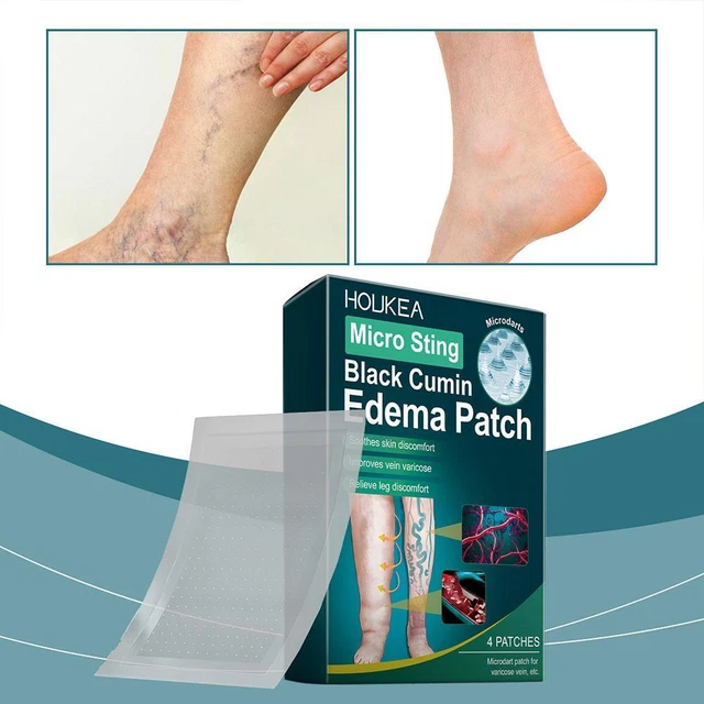 BLACK CUMIN EDEMA Patch Intravenous Maintenance Promotes Circulation ...