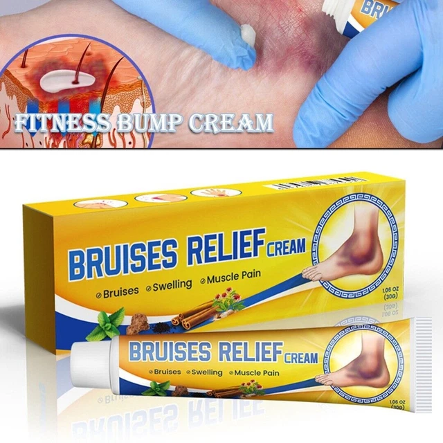BRUISES RELIEF CREAM for Bruising and Swelling Naturally Soothes A EUR ...