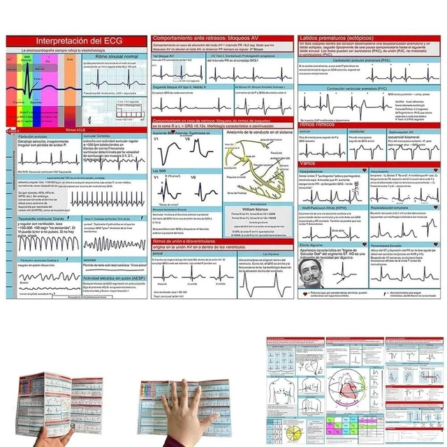 CARDIAC RHYTHM EKG Pocket Guide EKG Interpretation Book for Students £5 ...