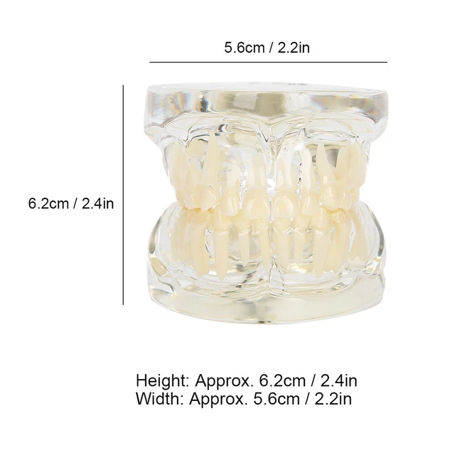 DENTAL DECIDUOUS TEETH Model Removable Teeth Model Teaching Tool For ...