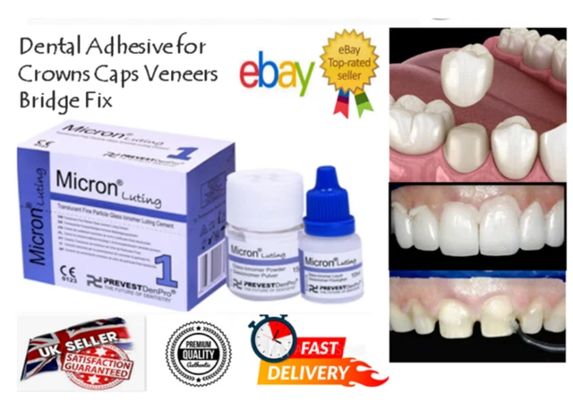 PERMANENT DENTAL CEMENT for Caps Crown Bridges Inlays Teeth DIY Tooth ...