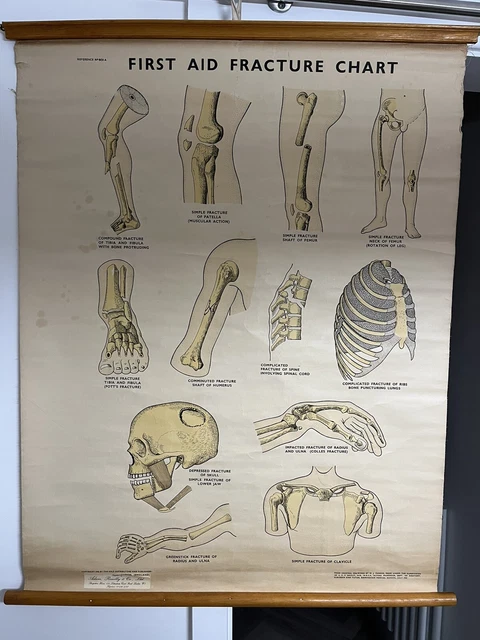 ANTIQUE VINTAGE ADAM Rouilly Wall Chart Poster Medical First Aid ...