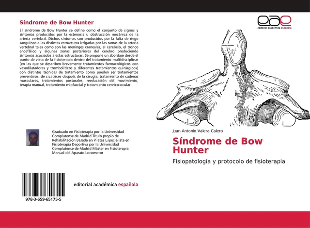 JUAN ANTONIO VA Síndrome de Bow Hunter: Fisiopatología y protocolo de f ...