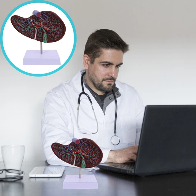 HUMAN STUDY MODEL Medical Teaching Model Liver Anatomy Model £58.85 ...