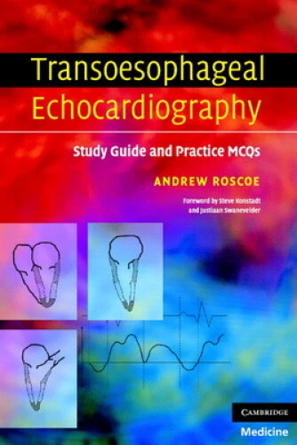 TRANSOESOPHAGEAL ECHOCARDIOGRAPHY: STUDY Guide and Practice Questions £ ...