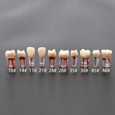 DENTAL ENDODONTIC RCT Root Canal Teeth Practice Model Pulp Blocks Study ...