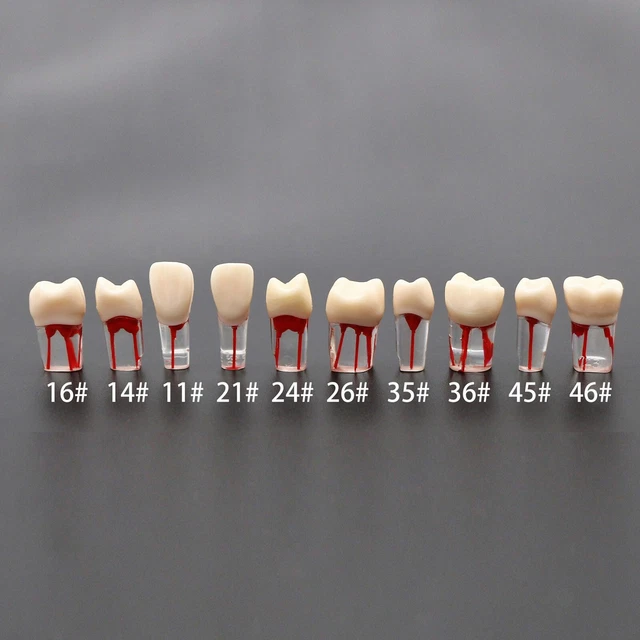 Dental Rct Root Canal Practice Model 10Pc Dental Tooth Model Endodontic ...