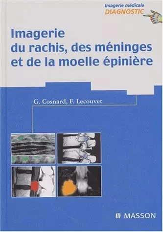 IMAGERIE DU RACHIS, des méninges et de la moelle épinière, Guy Cosnard ...