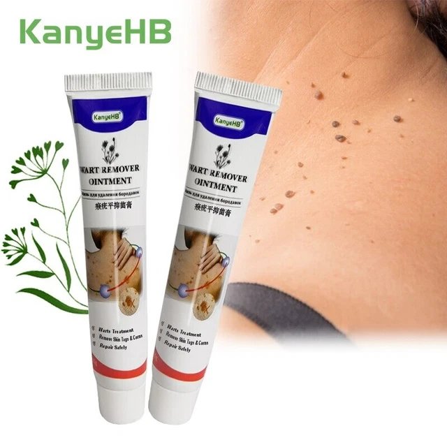 1 X RIMOZIONE verruche unguento antibatterico trattamento verruche ...