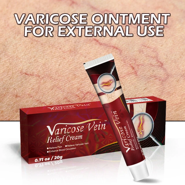 VARICOSE VEINS RELIEF Cream Vasculitis Phlebitis Spider Pain Relief ...