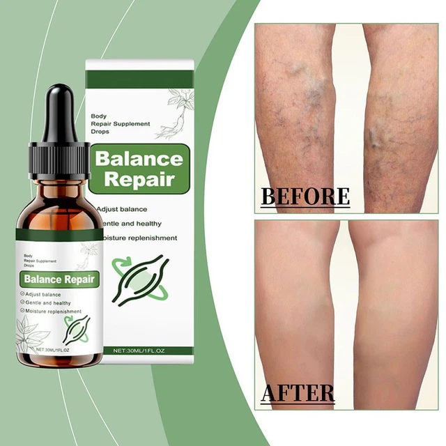 30ML MULLEIN LEAF Extract Drops Natual Detox Health Supplement Anti Leg ...