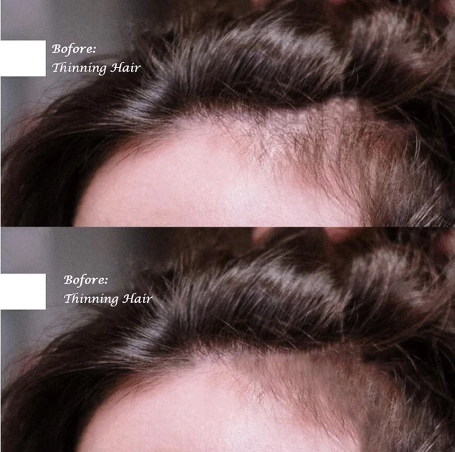 LEIF LEA ROSEMARY Oil for Hair Growth Leif Lea Hair Growth Serum 30ml £ ...