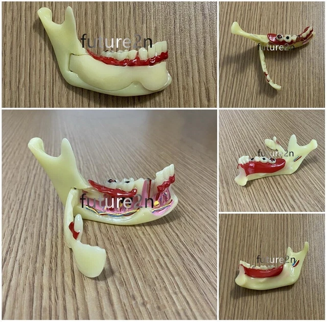 NEW DENTAL MANDIBULAR Tissue Teeth Anatomical Models Patient Study ...