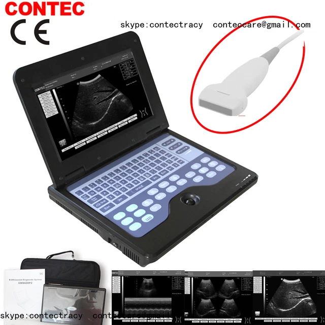 ESCÁNER DE ULTRASONIDO CONTEC CMS600P2 máquina de diagnóstico portátil ...