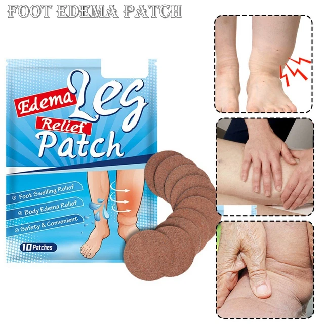 EDEMA LEG RELIEF Patch Varicose Veins Vasculitis Phlebitis Spider Leg D ...
