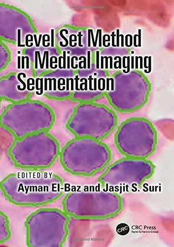 LEVEL SET METHOD in Medical Imaging Segmentation, El-Baz, Suri ...