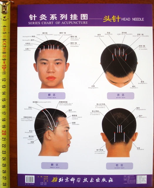 AFFICHE ACUPUNCTURE-TÊTE-HEAD ACUPOINTS chart-Cartel acupuntura ...