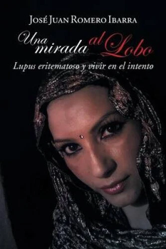 UNA MIRADA AL Lobo: Lupus Eritematoso y Vivir En El Intento [Spanish ...