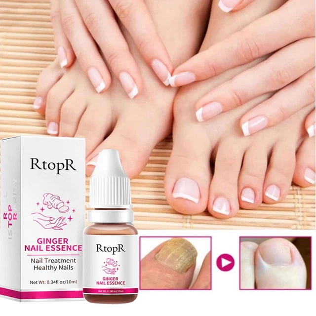 GINGER NAIL ESSENCE Nail Repair Nail Bright Oil Nail Treatment10ml ...