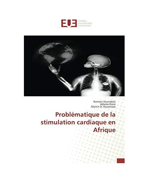 PROBLÉMATIQUE DE LA stimulation cardiaque en Afrique, Romain Houndolo ...