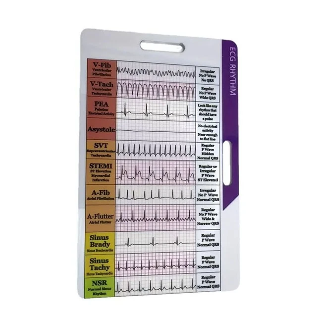 ECG/EKG RHYTHM POCKET Card,Double Sided Design EKG Interpretation Badge ...