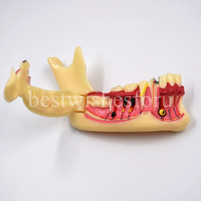 NEW DENTAL MANDIBULAR Tissue Teeth Anatomical Models Patient Study ...