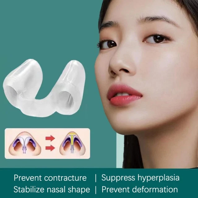 CLEAR NOSTRIL SUPPORT Shaping Rhinoplasty Crooked Nose Correction ...